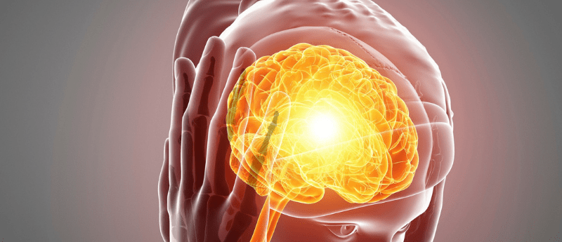 Electrical neuromodulation for chronic migraines - Neuro Central
